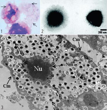 The 2003 Discovery of Mimivirus, a Giant Virus Mimicking Bacteria ...