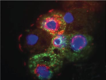 The 2003 Discovery of Mimivirus, a Giant Virus Mimicking Bacteria ...