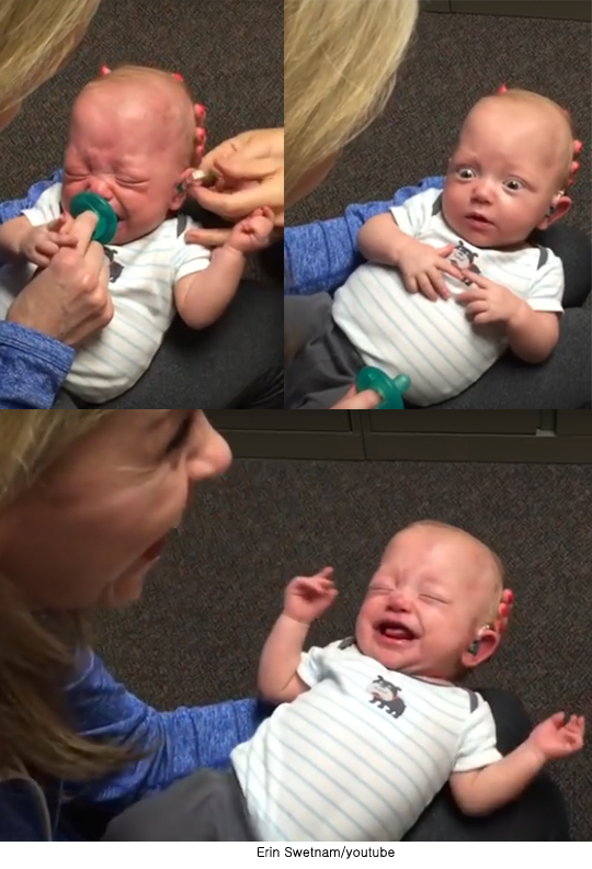 Deaf Baby Hears His Mother's Voice for the First Time - DongA Science