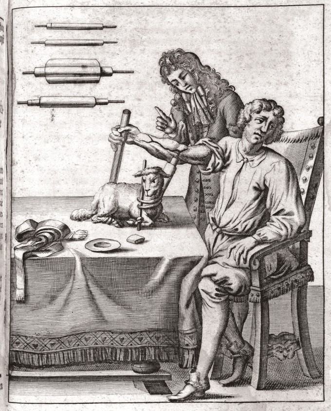 [Science Minute] June 15, 1667: The First Successful Human Blood ...