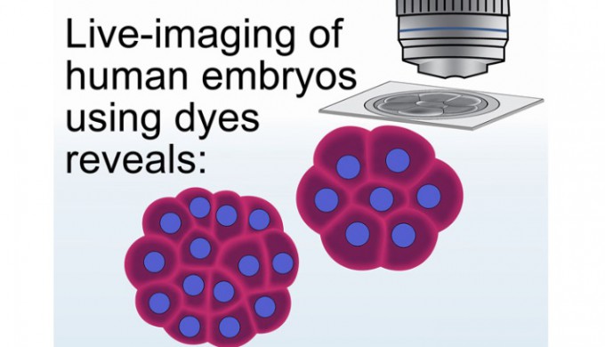 High-Resolution, Real-Time Imaging Captures Live Human Embryos - DongA ...