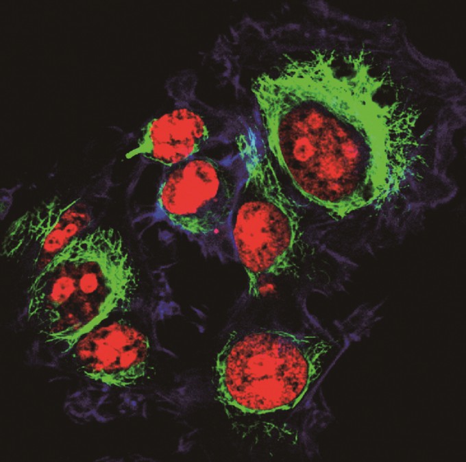 'Immortal' HeLa Cells Compensated After More Than 70 Years - DongA Science