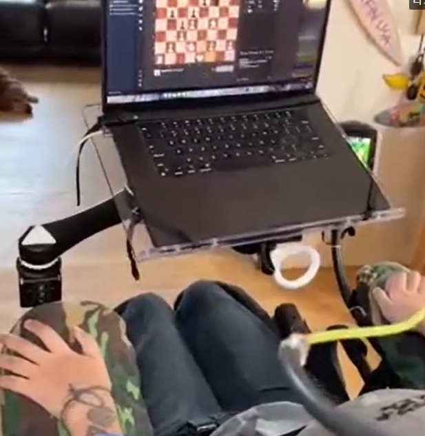 Paralyzed Patient with 'Neuralink Chip' Implant Plays Chess Using Only ...