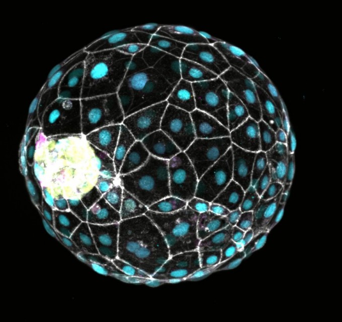 Scientists Discover How to 'Pause' Human Embryo Development, A ...