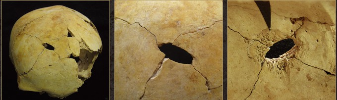 Traces of Cannibalism Carved into 4,000-Year-Old Skulls... 'A Deep ...