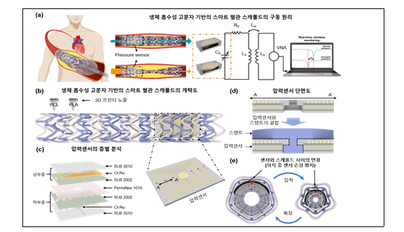 A Replacement for Metal Stents? Korean Researchers Develop Naturally ...