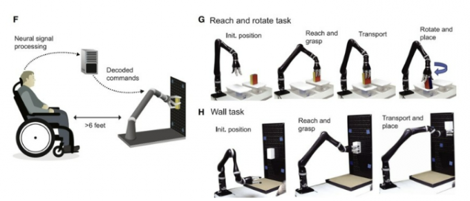Patient with Quadriplegia Controls Robotic Arm with a Thought - DongA ...