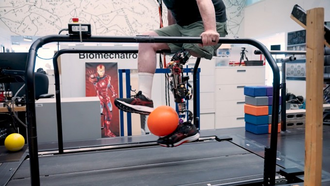 Prosthetic Leg Directly Connected to Nerves and Muscles Allows Users to ...