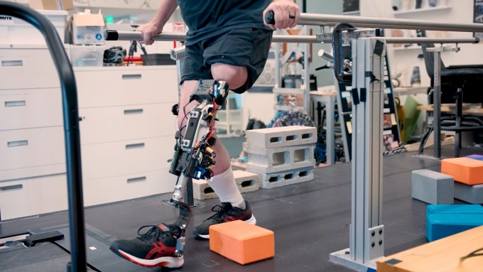 Prosthetic Leg Directly Connected to Nerves and Muscles Allows Users to ...
