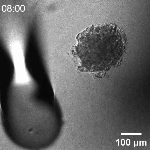 World's First Video of Human Embryo Implantation Unveiled, Potentially ...