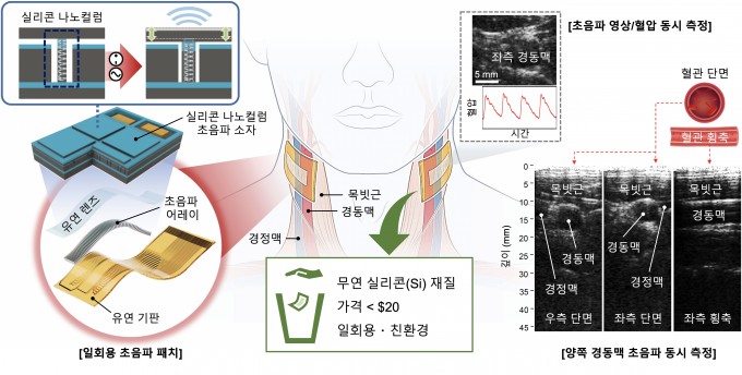 Lead-Free, Eco-Friendly Medical Silicone Ultrasound Patch Developed ...