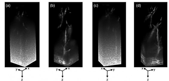 Ultrasound technique visualizes deep blood vessels in 3D without ...
